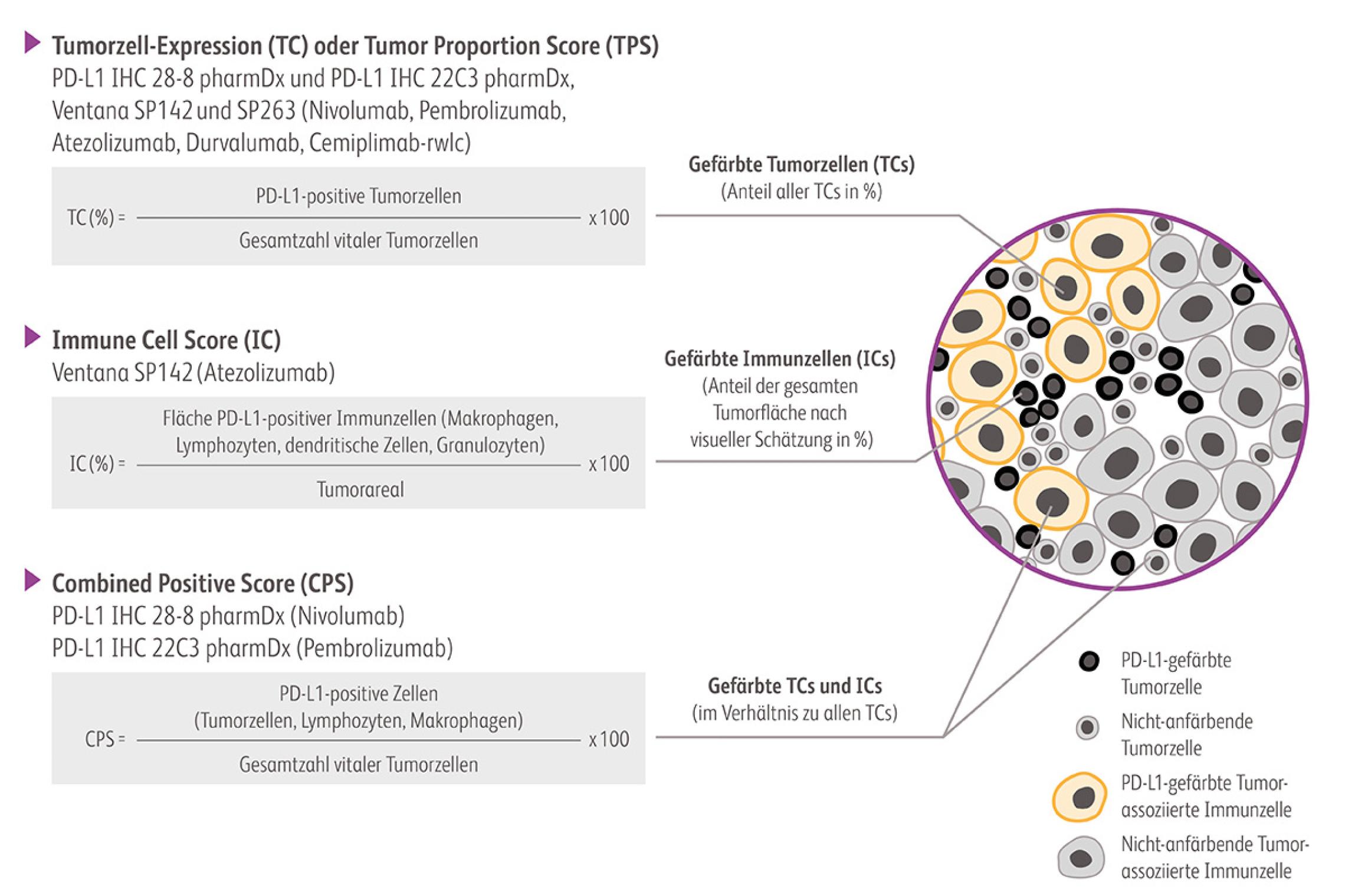 Präzisionsmedizin – PD-L1 | BMS-Onkologie